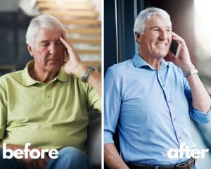 Results of HGH Therapy Timeline | Before and After Pics of Patients