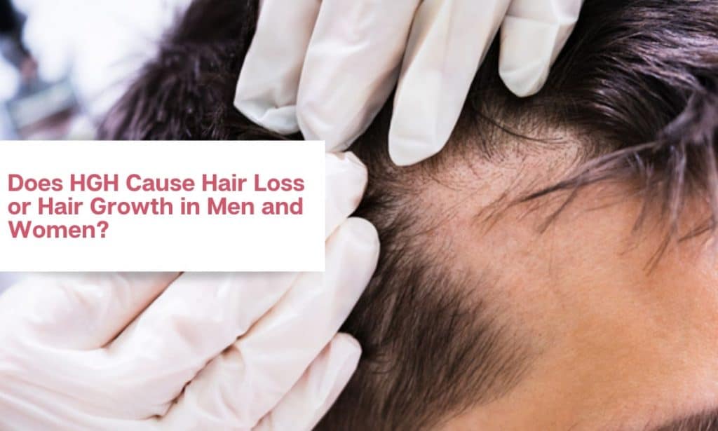 Does HGH Cause Hair Loss or Hair Growth?